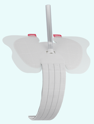 Thermal Balloon Catheter