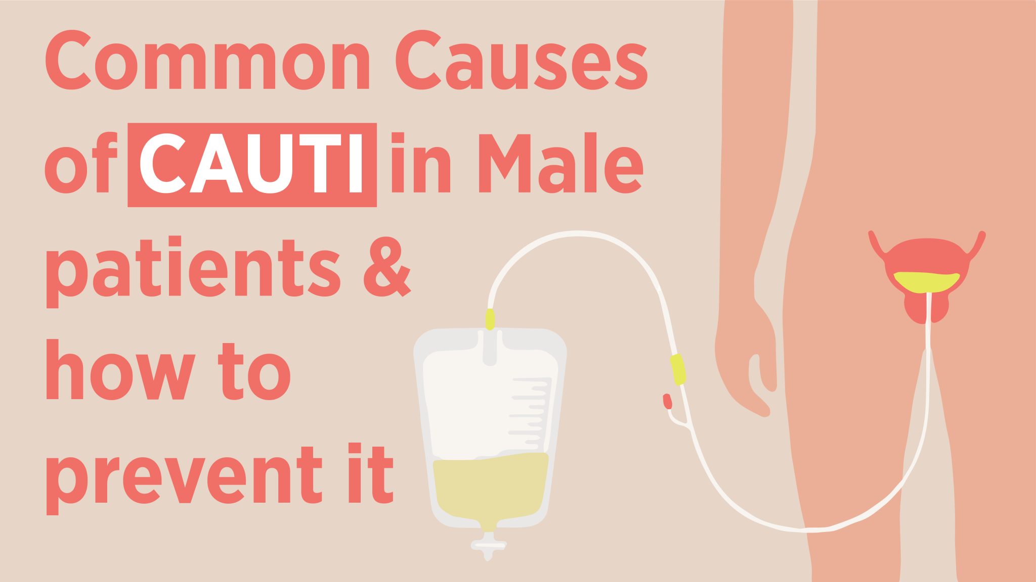 Common Causes Of Male Catheter Associated Urinary Tract Infections