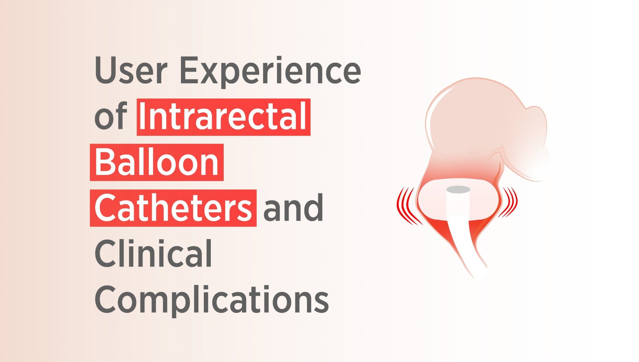 User Experience of Intrarectal Balloon Catheters and Clinical ...