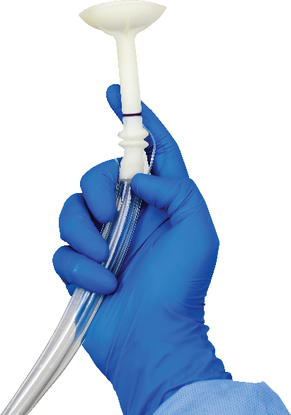 Is overinflating balloon catheter safe for patients? - Consure Medical